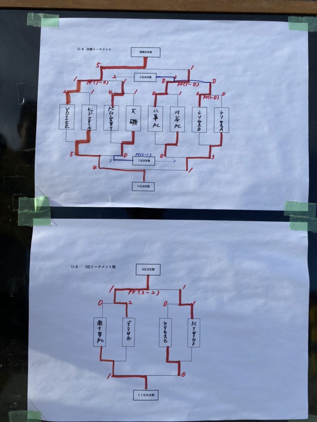シリウスカップU8 | MFC.VOICE